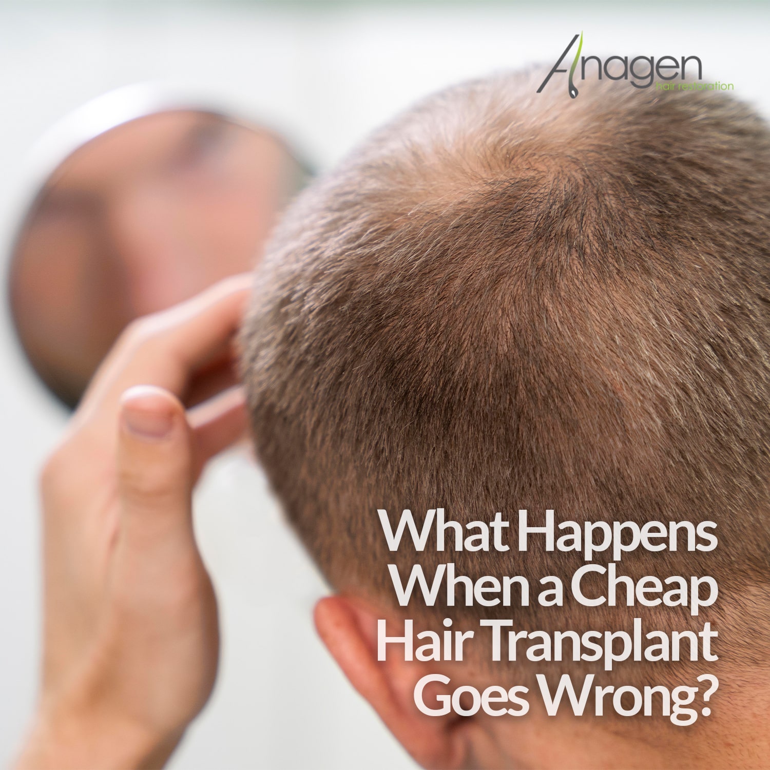 What Happens When a Cheap Hair Transplant Goes Wrong? - Anagen Hair ...