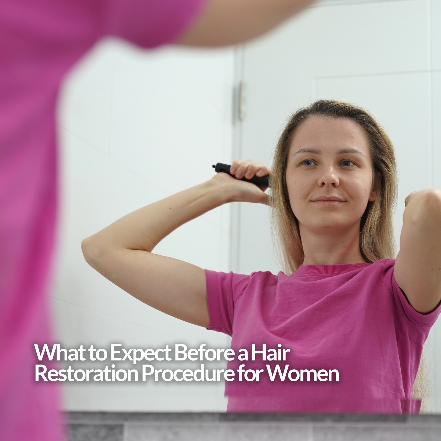 What to Expect Before a Hair Restoration Procedure for Women - Anagen ...